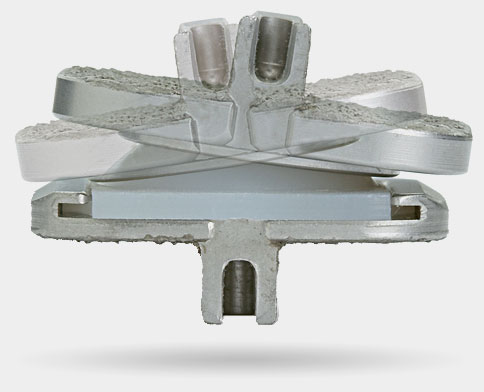 Disc Replacement Spinal Kinetics M6 Artificial Disc Replacement